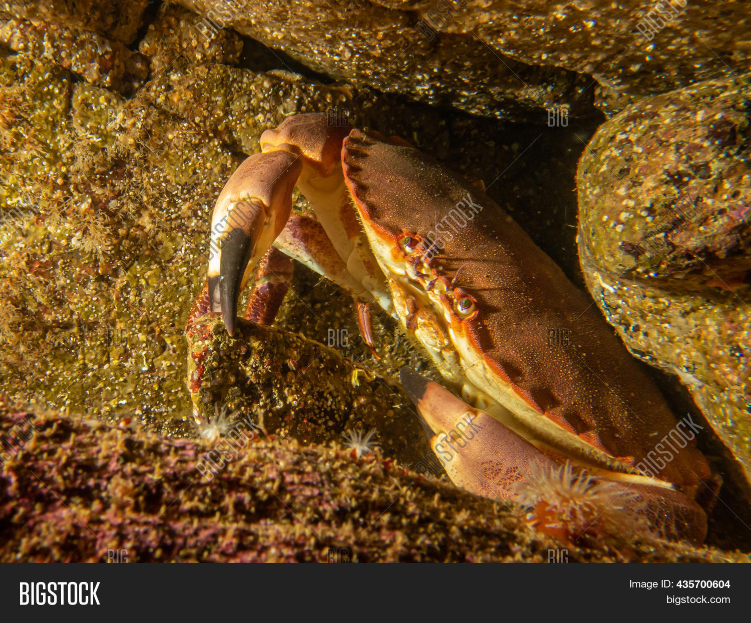 Closeup Picture Cancer Image & Photo (Free Trial) | Bigstock