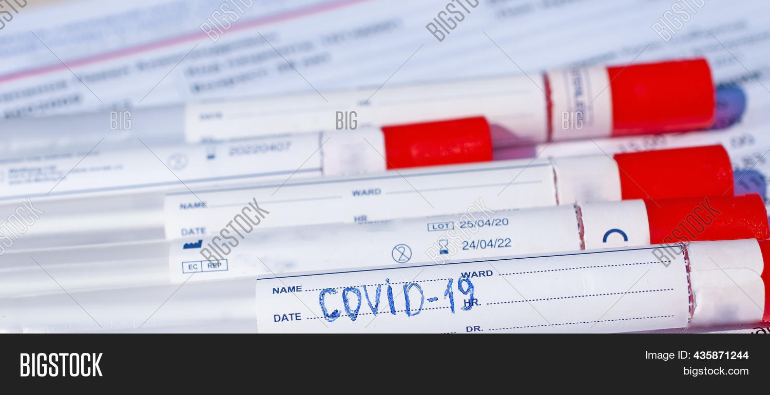 Test Tubes Results Image & Photo (Free Trial) | Bigstock