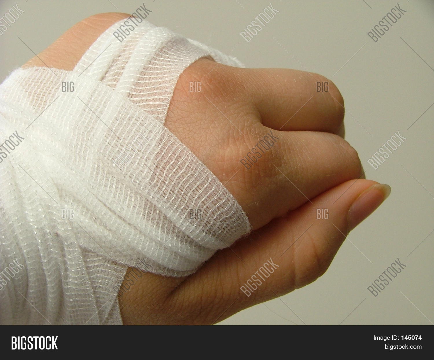 Injury Image & Photo (Free Trial) | Bigstock