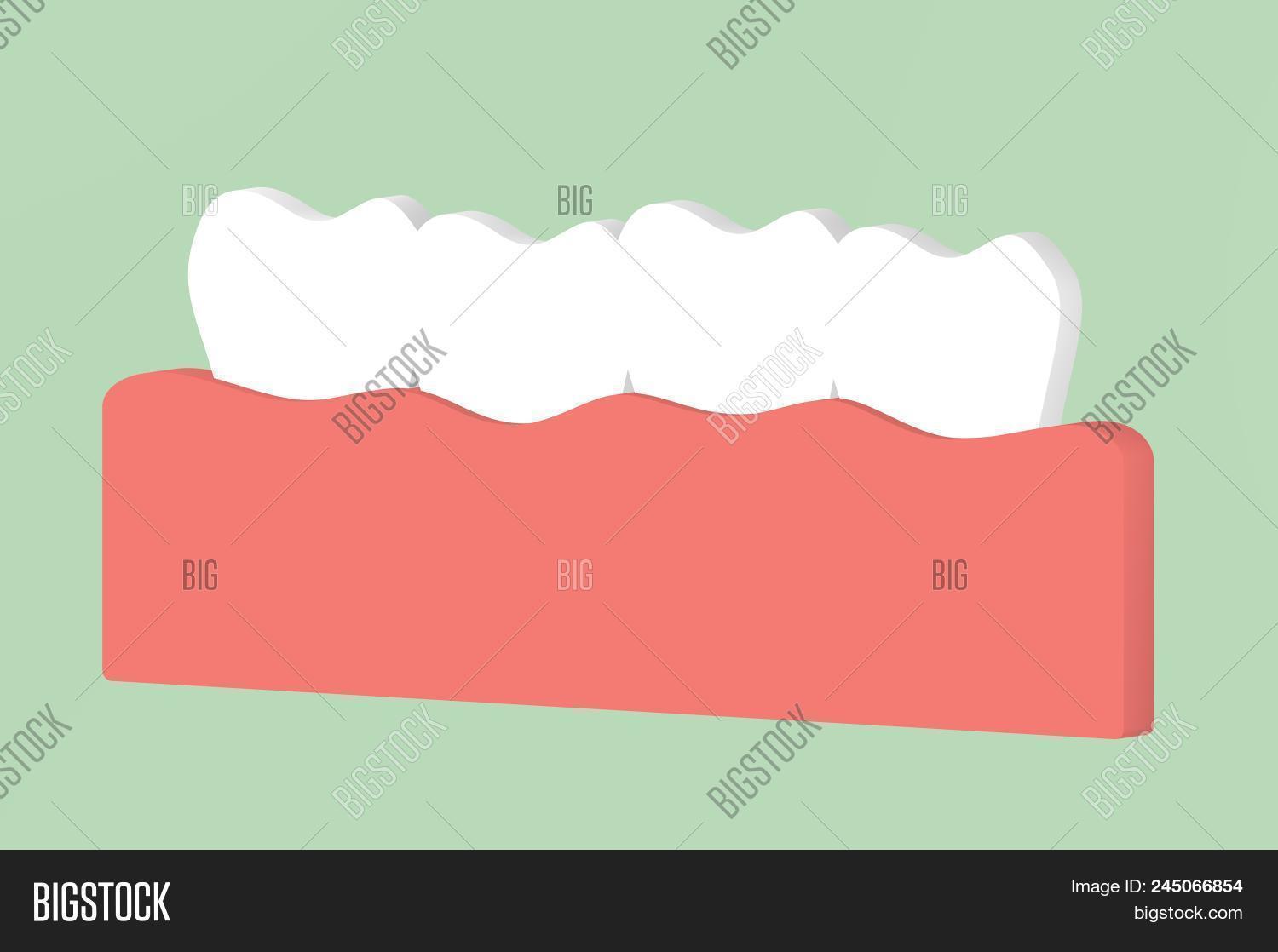 Crowding Teeth ( Image & Photo (Free Trial) | Bigstock
