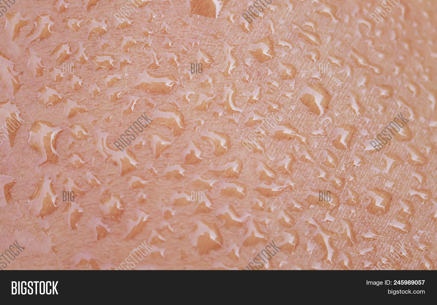 Texture Human Skin Image & Photo (Free Trial) | Bigstock