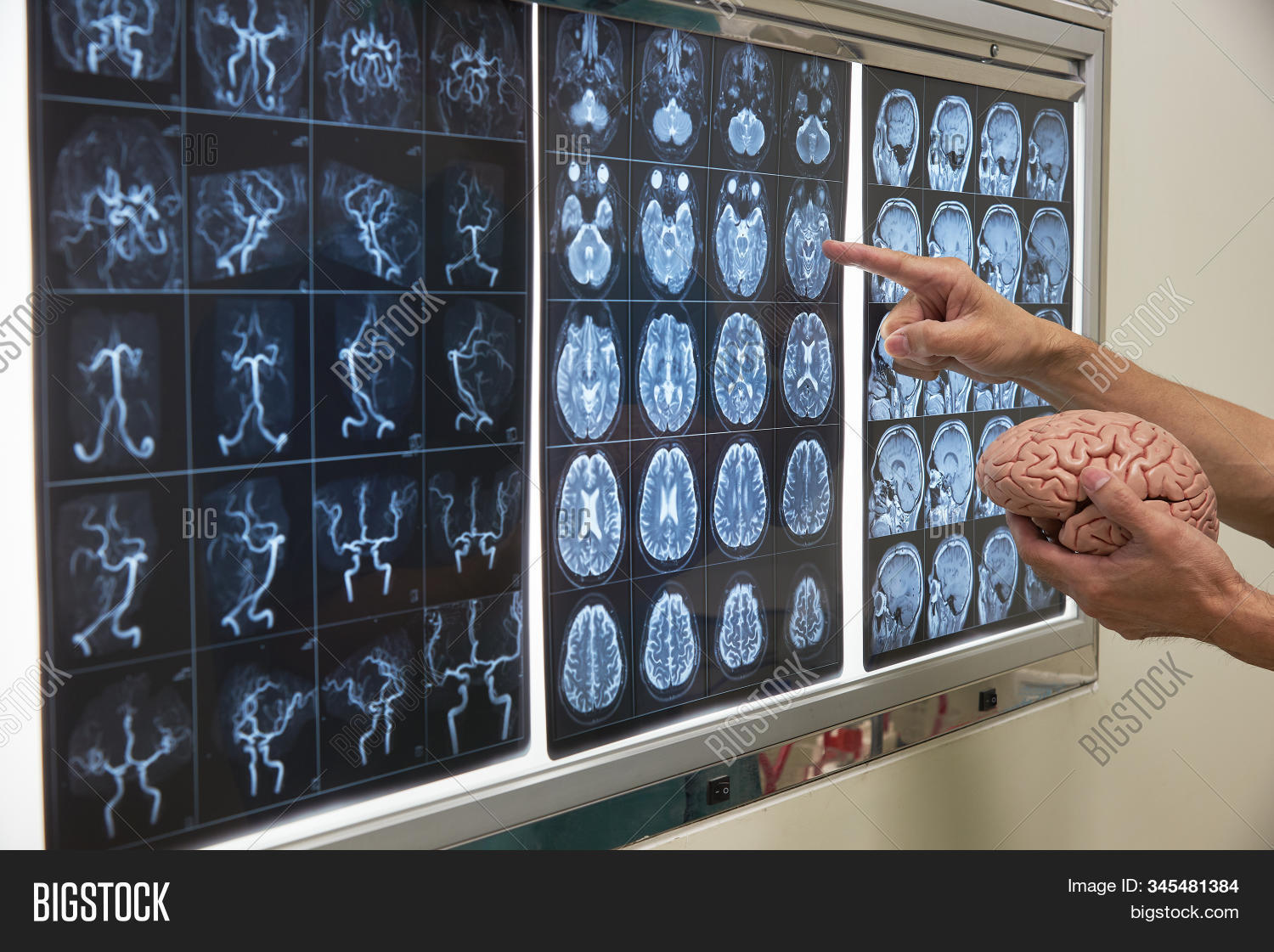 Human Brain Model On Image & Photo (Free Trial) | Bigstock