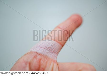Wound On Index Finger Image & Photo (Free Trial) | Bigstock