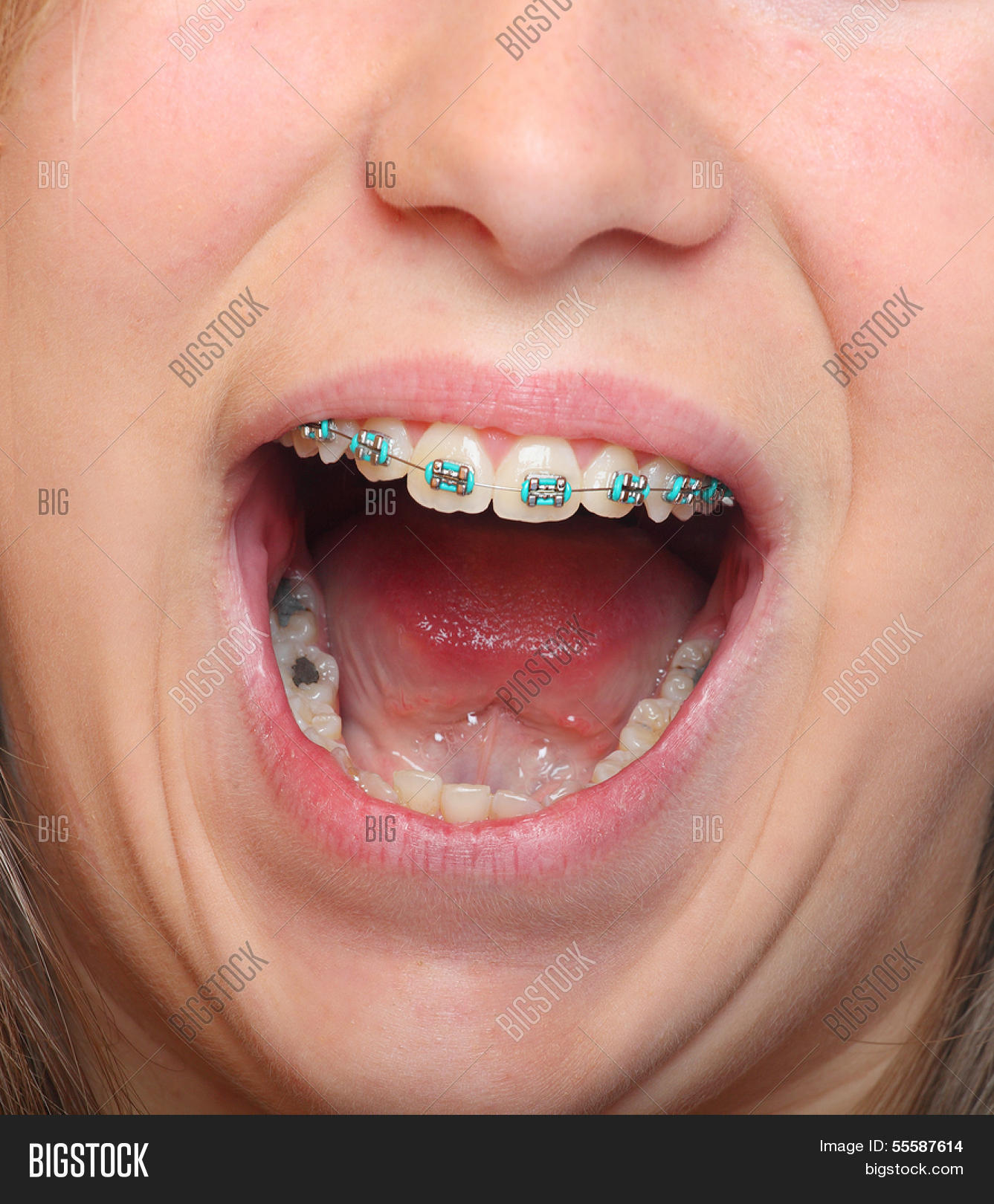 Close Smile Teenage Image & Photo (Free Trial) | Bigstock