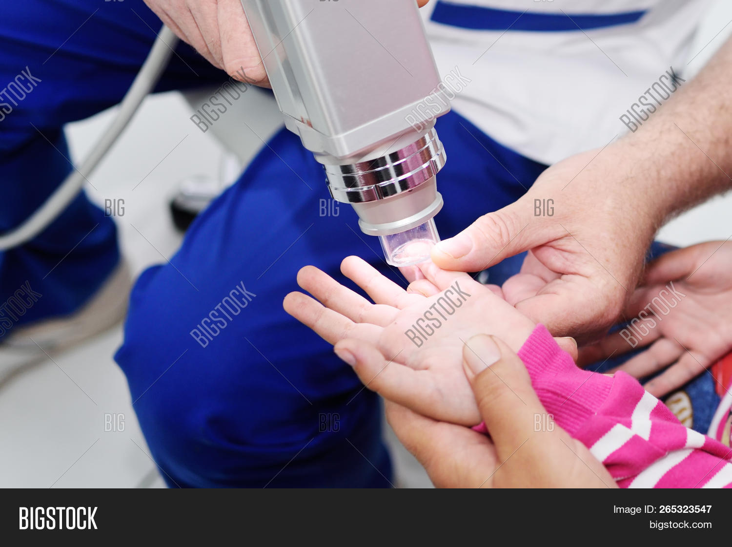 Removal Warts Image & Photo (Free Trial) | Bigstock