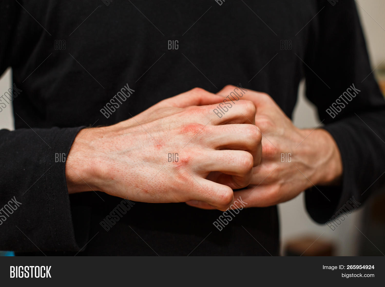 Man Scratch Oneself, Image & Photo (Free Trial) | Bigstock