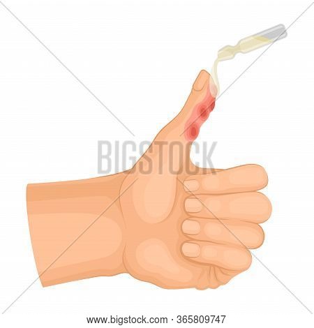First Aid Hand Vector & Photo (Free Trial) | Bigstock