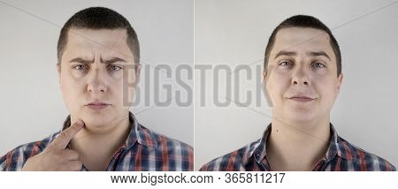 Man Has Second Chin. Image & Photo (Free Trial) | Bigstock