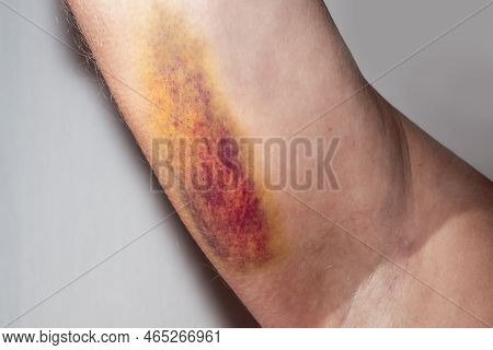 Man's Arm Large Image & Photo (Free Trial) | Bigstock