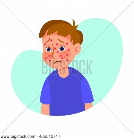 Ill Boy Large Skin Vector & Photo (Free Trial) | Bigstock