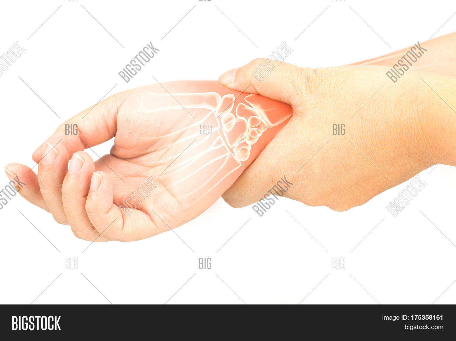Wrist Bones Injury Image & Photo (Free Trial) | Bigstock
