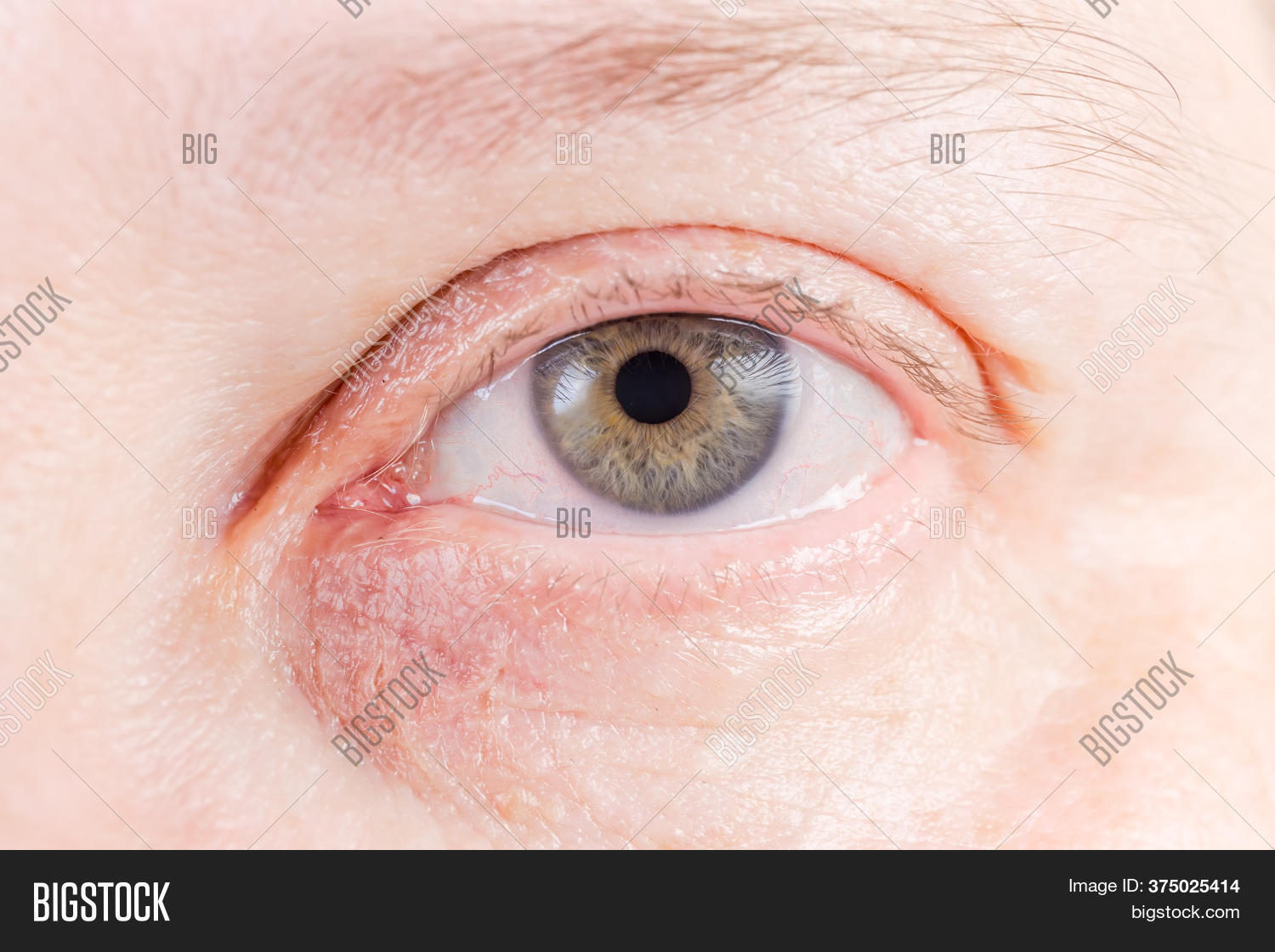 Human Eye Gray Iris Image & Photo (Free Trial) | Bigstock