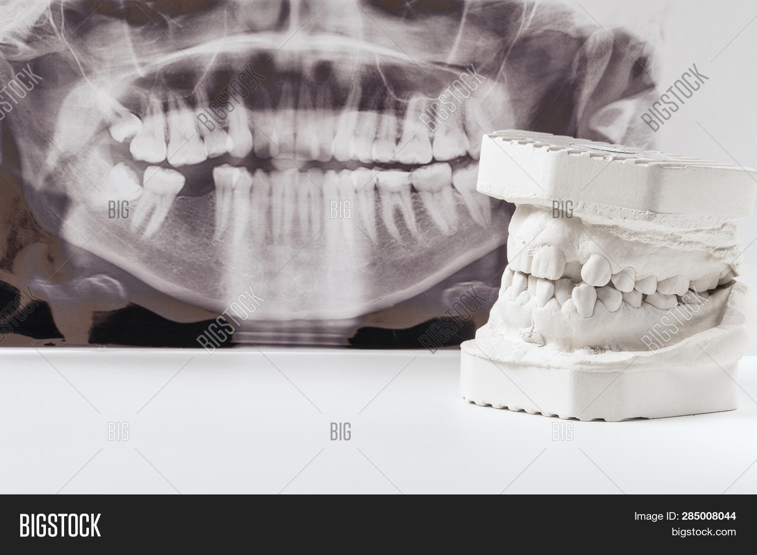 Dental Casting Gypsum Image & Photo (Free Trial) | Bigstock