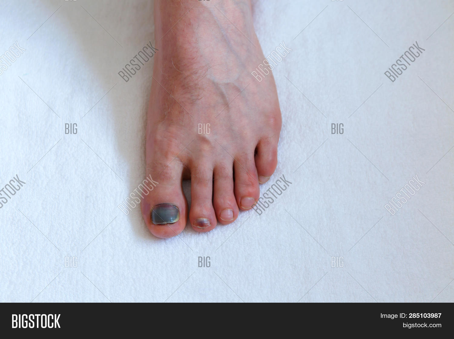 Human Male Left Foot Image & Photo (Free Trial) | Bigstock