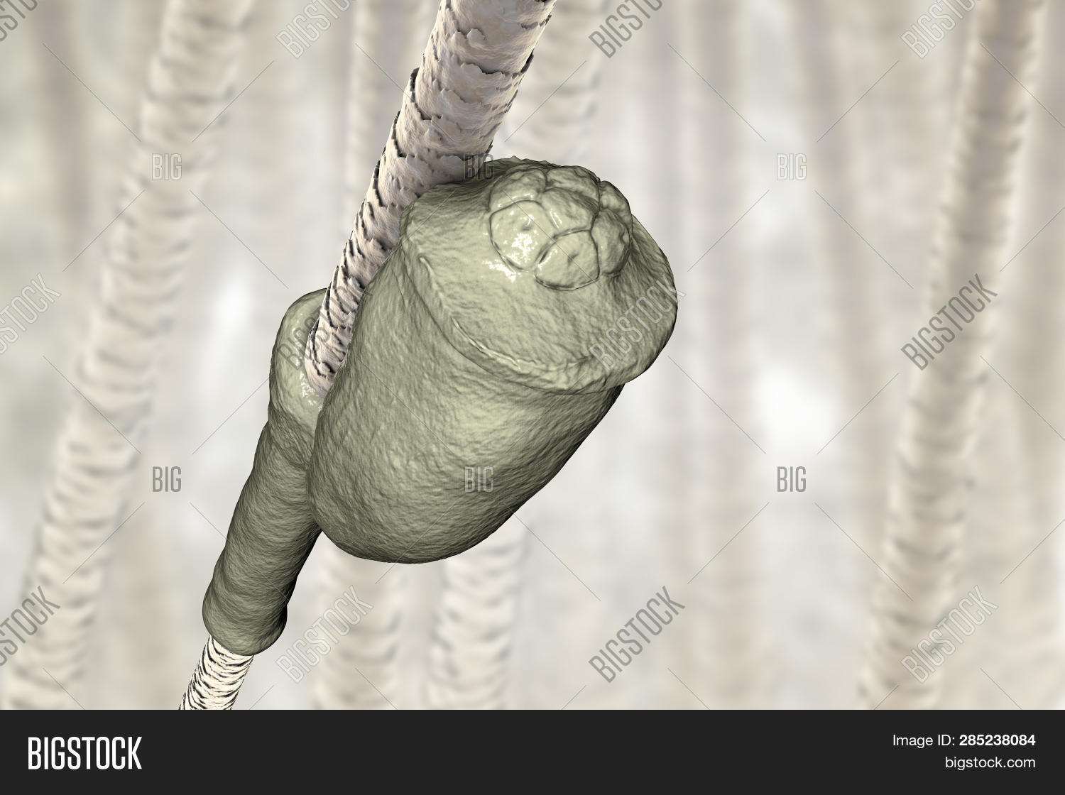 Human Head Louse Nit Image & Photo (Free Trial) | Bigstock
