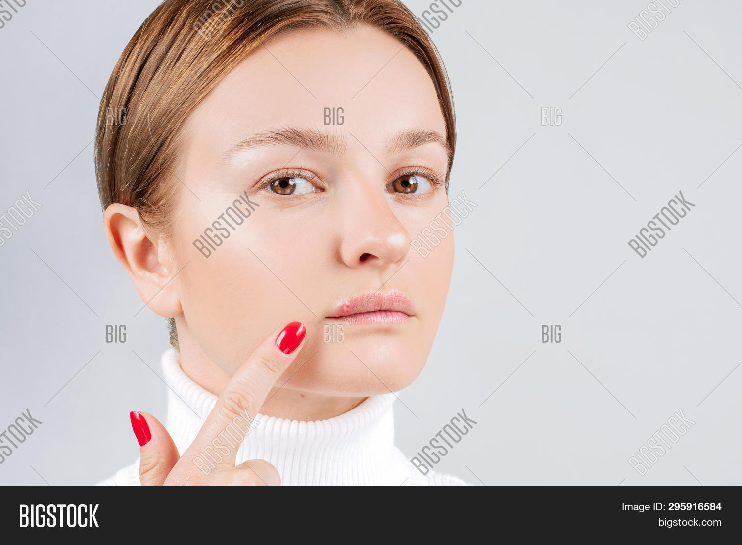 Woman Cold Sore Image And Photo Free Trial Bigstock