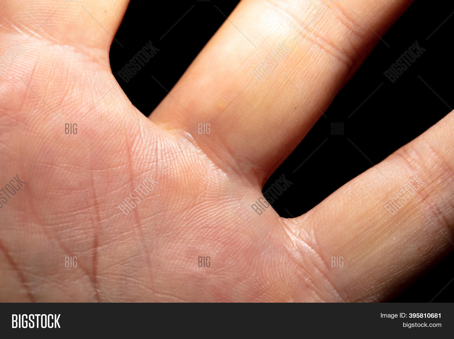 Close- Lines On Human Image & Photo (Free Trial) | Bigstock