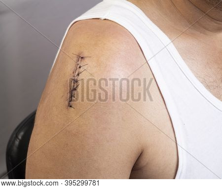 Front Side Closeup Image & Photo (Free Trial) | Bigstock