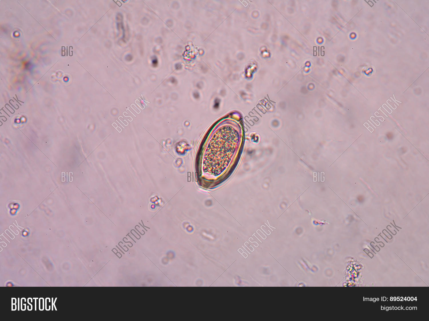 Trichuris Trichiura Image & Photo (Free Trial) | Bigstock