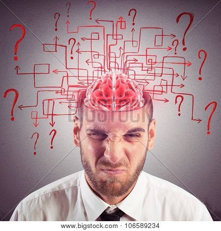 Confused Brain Image & Photo (Free Trial) | Bigstock