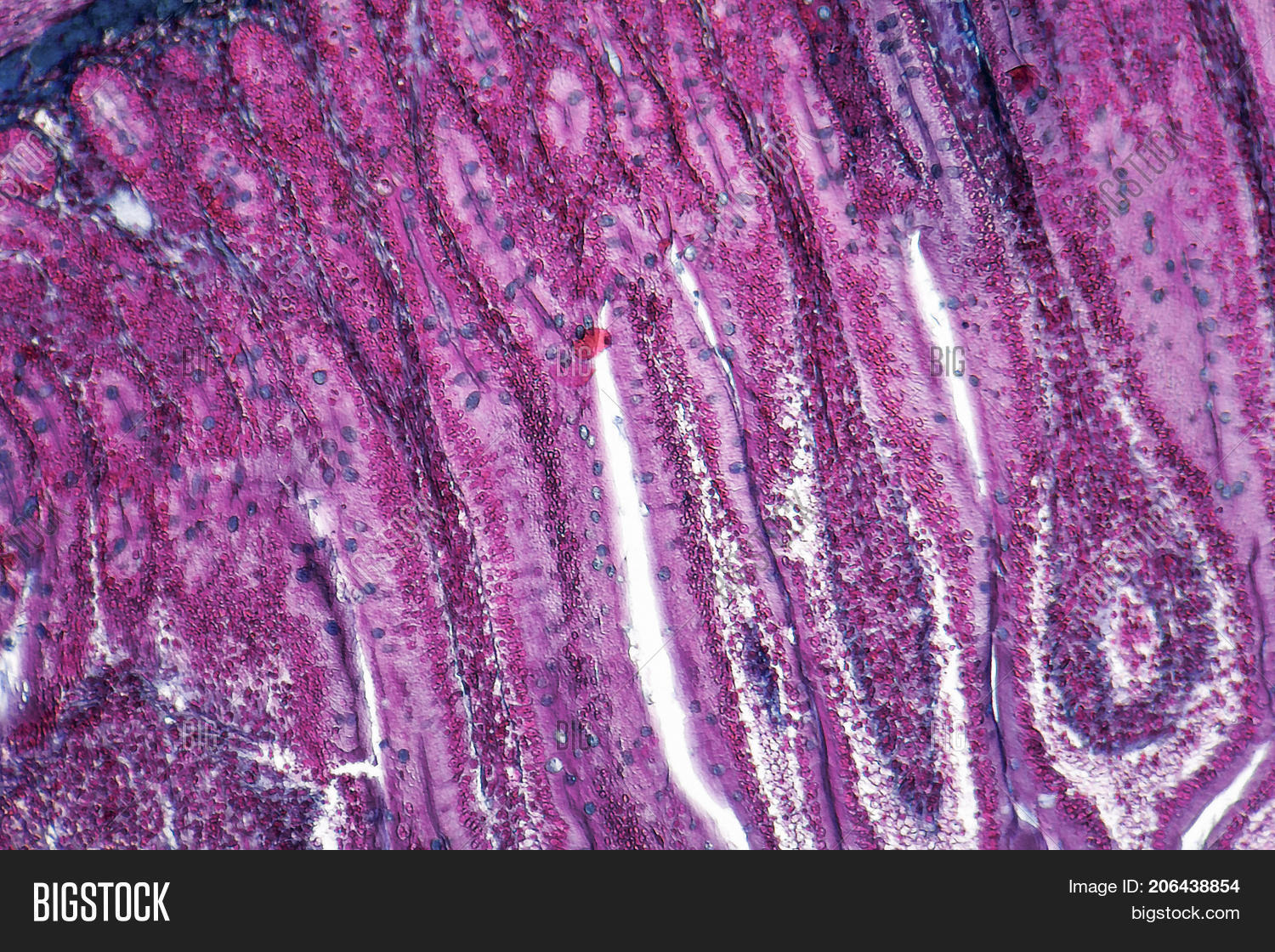 Full Frame Duodenum Image & Photo (Free Trial) | Bigstock