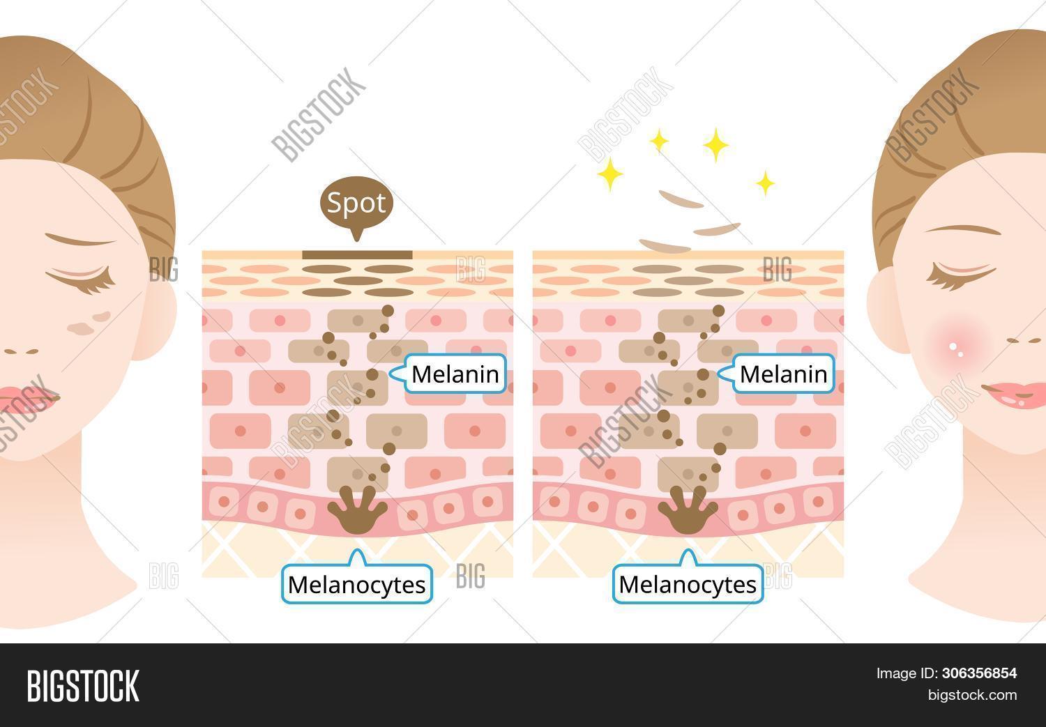 Infographic Skin Cell Image & Photo (Free Trial) | Bigstock