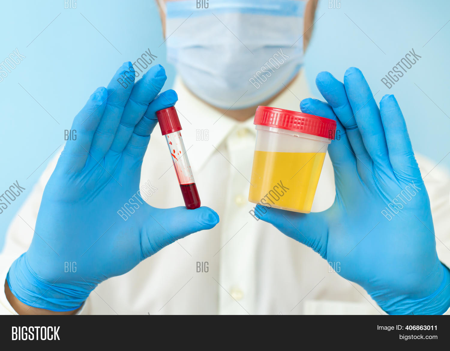Doctor Holding Urine Image & Photo (Free Trial) | Bigstock