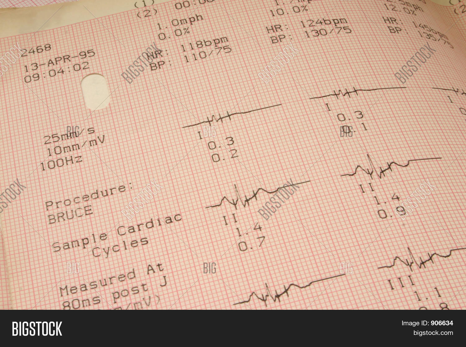Cardiological Test Image & Photo (Free Trial) | Bigstock