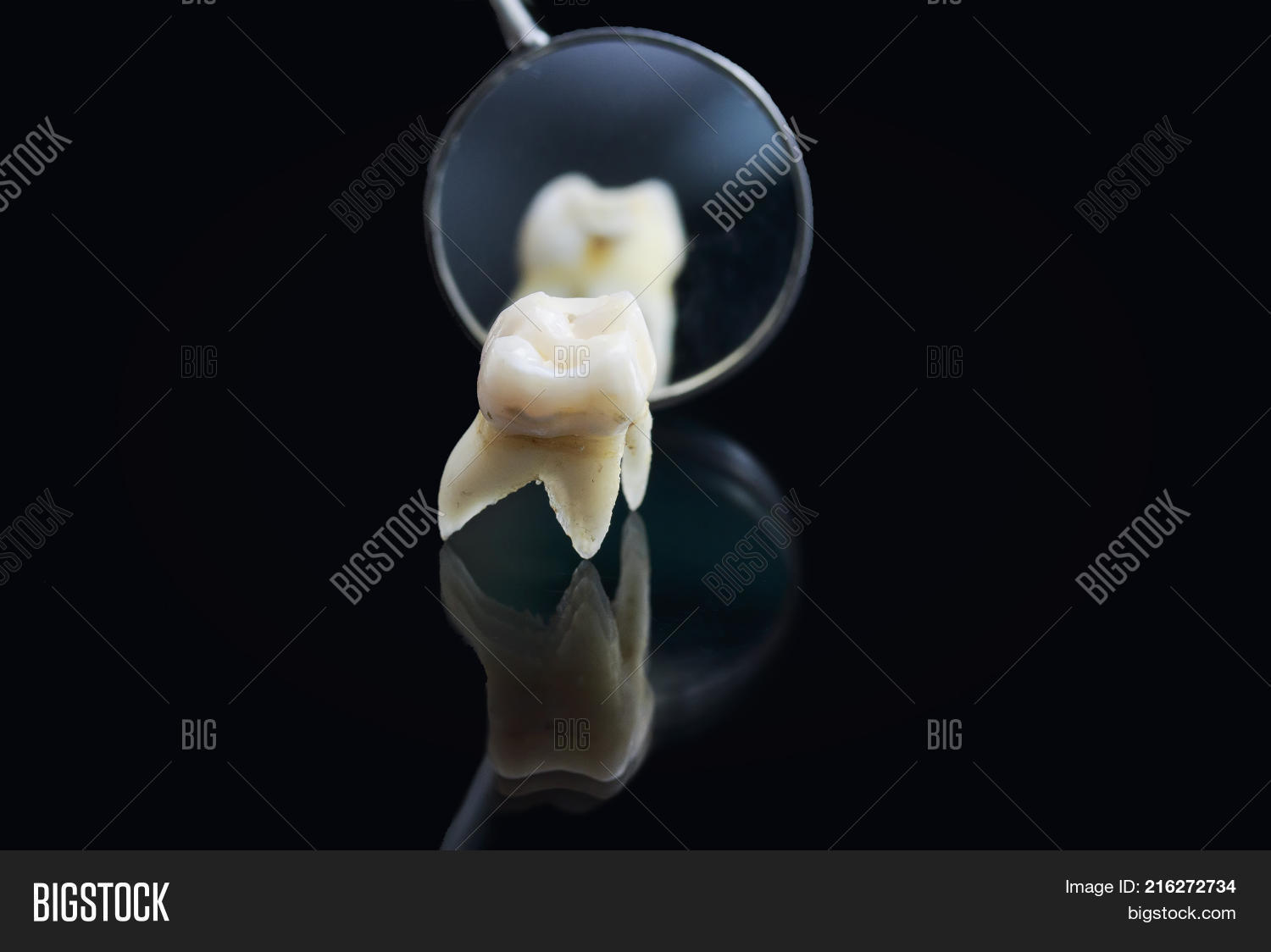 Bad Rotten Tooth Image & Photo (Free Trial) | Bigstock