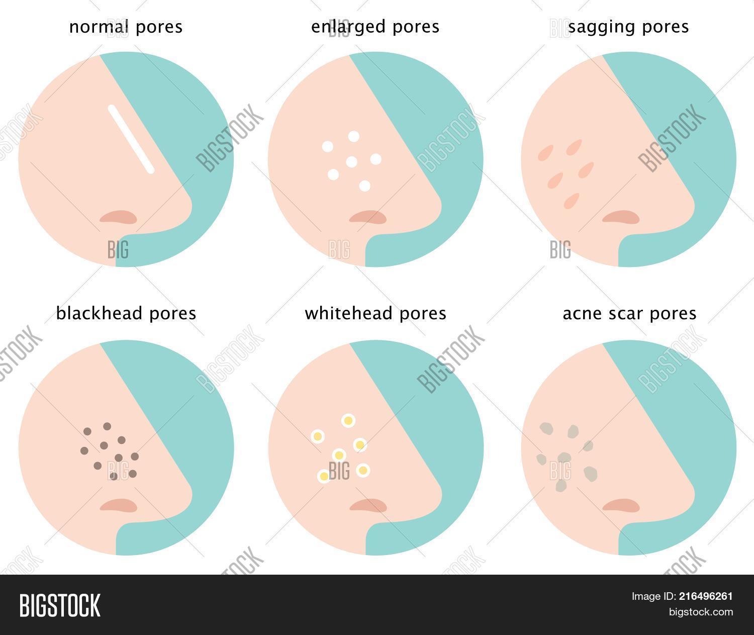 Set Skin Pores On Nose Image & Photo (Free Trial) | Bigstock