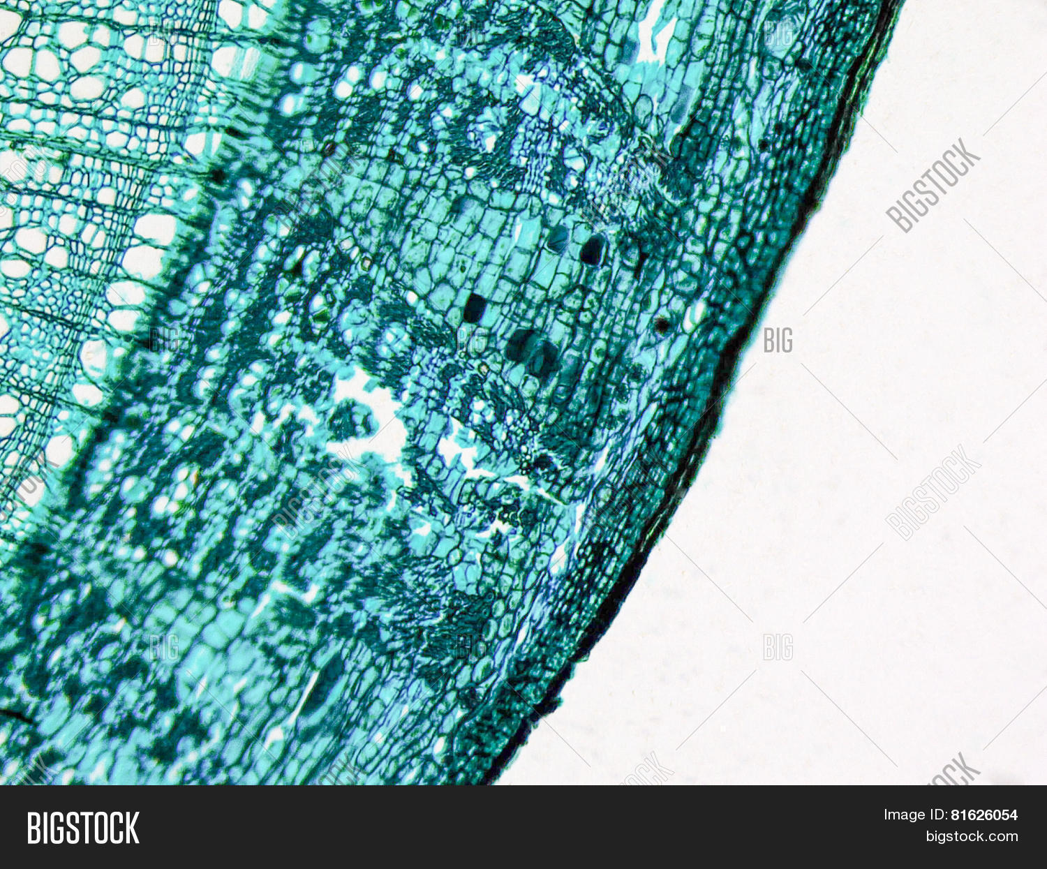 Tilia Stem Micrograph Image & Photo (Free Trial) | Bigstock