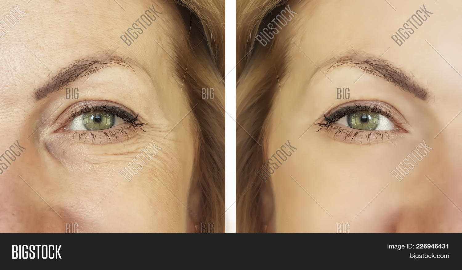 Face Woman Wrinkles Image & Photo (Free Trial) | Bigstock