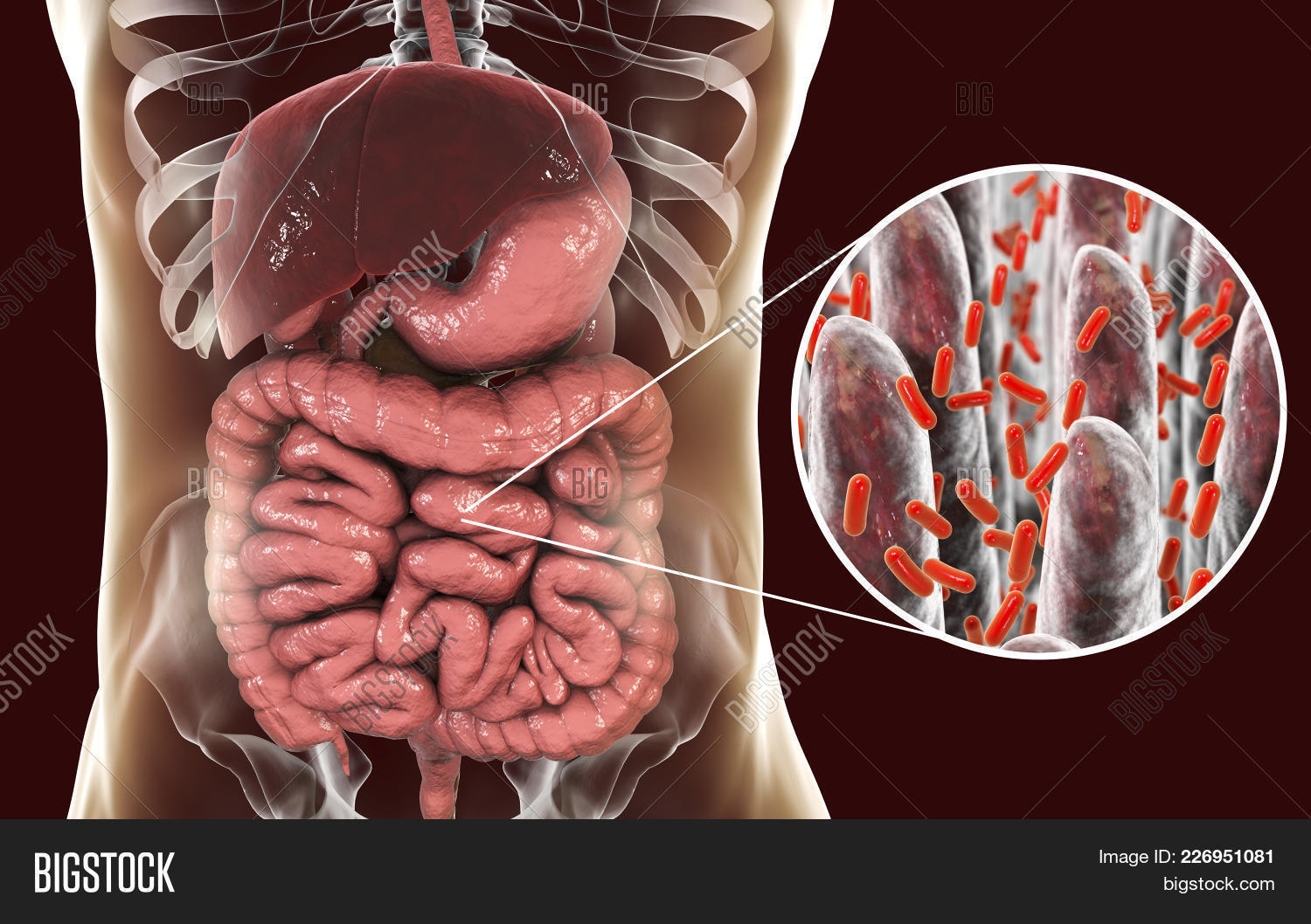 Intestinal Microbiome Image & Photo (Free Trial) | Bigstock