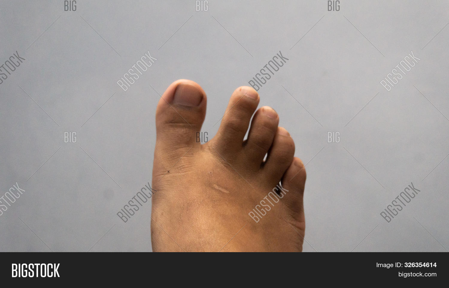 Close View Human Toes Image & Photo (Free Trial) | Bigstock
