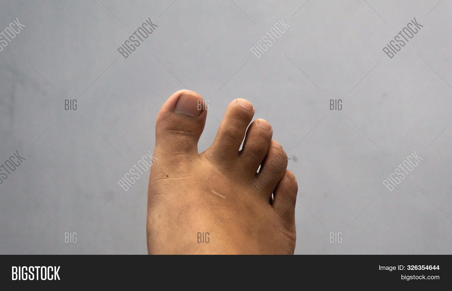 Close View Human Toes Image & Photo (Free Trial) | Bigstock