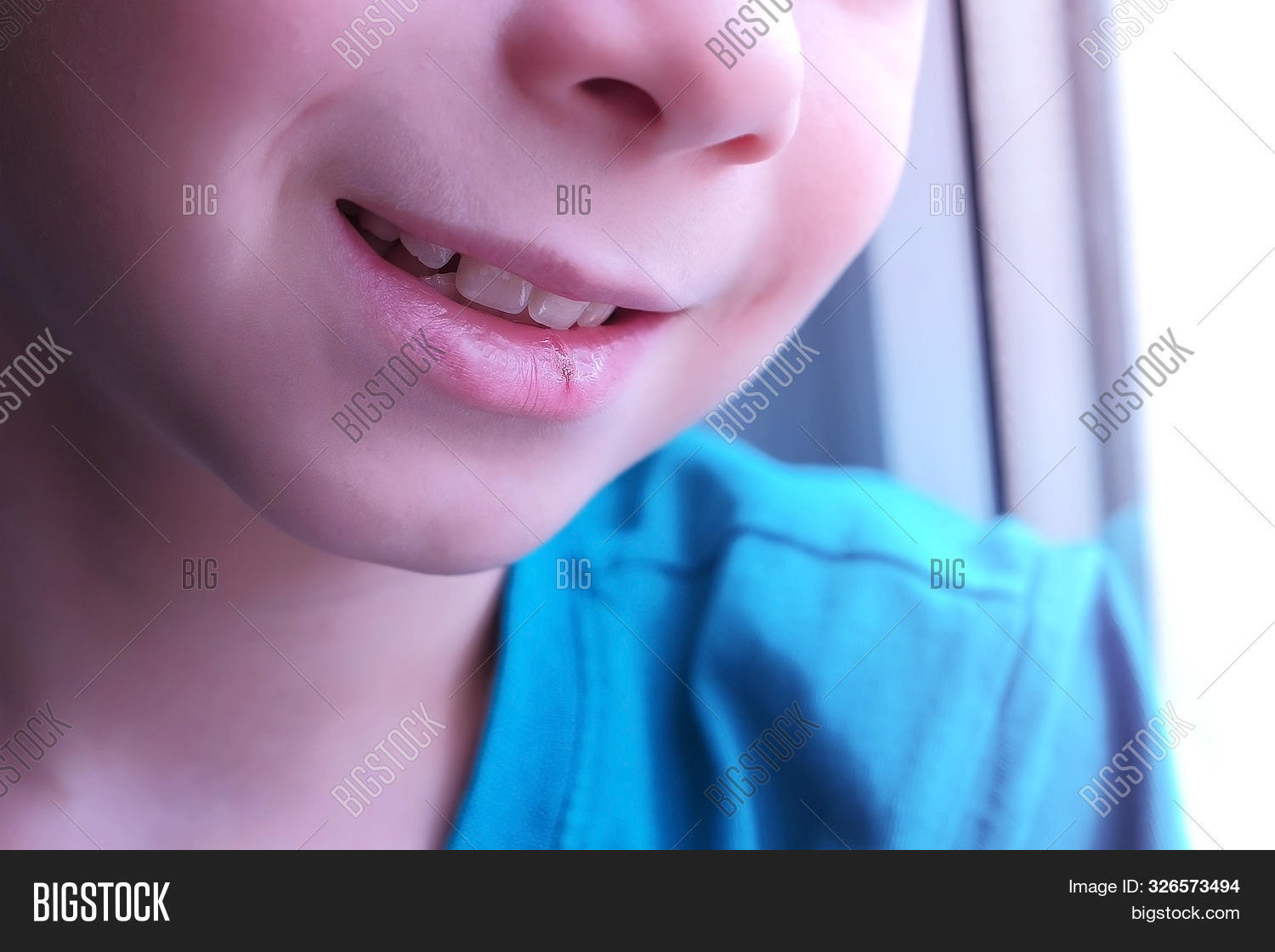 Little Cut On Boys Lip Image & Photo (Free Trial) | Bigstock