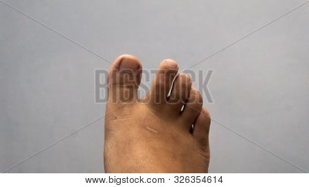 Close View Human Toes Image & Photo (Free Trial) | Bigstock