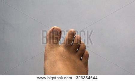 Close View Human Toes Image & Photo (Free Trial) | Bigstock
