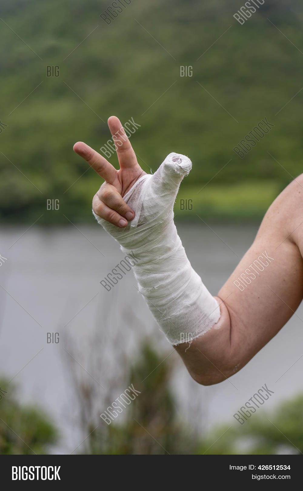 Male Hand Plaster Cast Image & Photo (Free Trial) | Bigstock