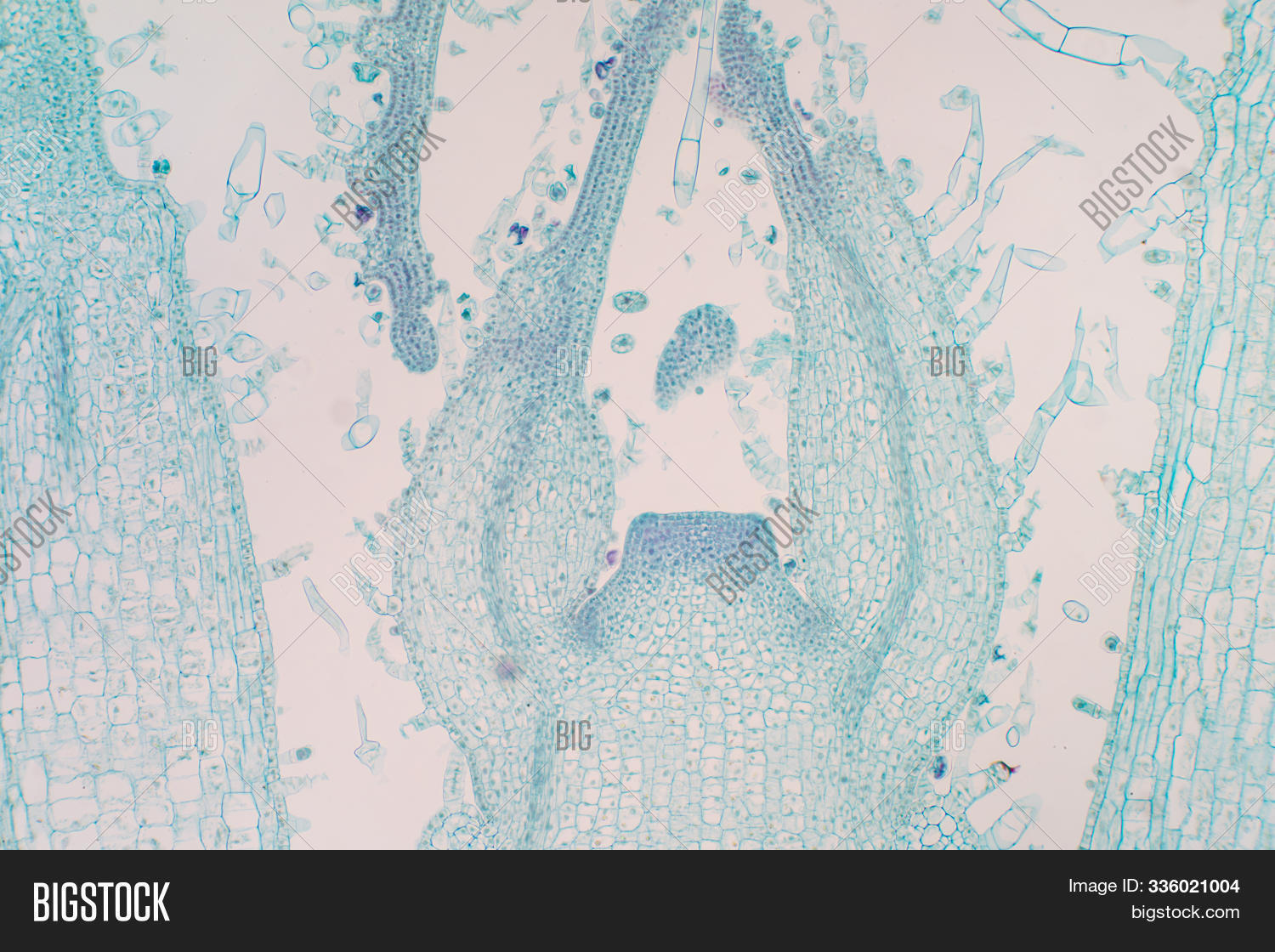 Shoot Meristem Tissue Image & Photo (Free Trial) | Bigstock