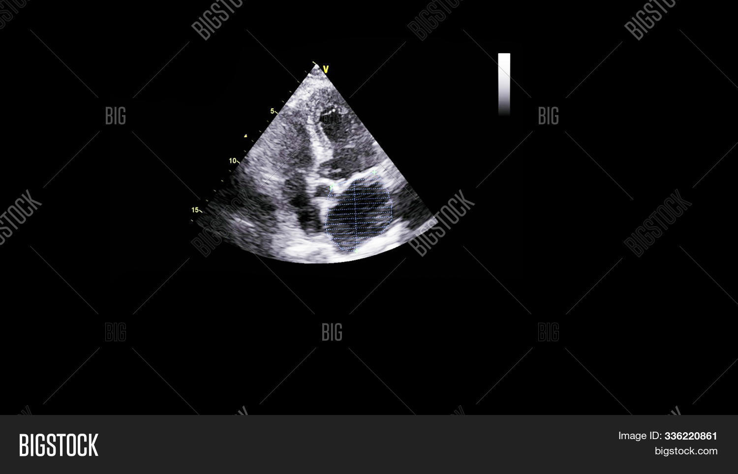 Image Heart Gray-scale Image & Photo (Free Trial) | Bigstock