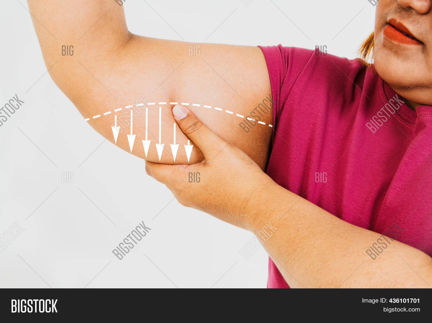 Unwanted Fat Under Her Image & Photo (Free Trial) | Bigstock