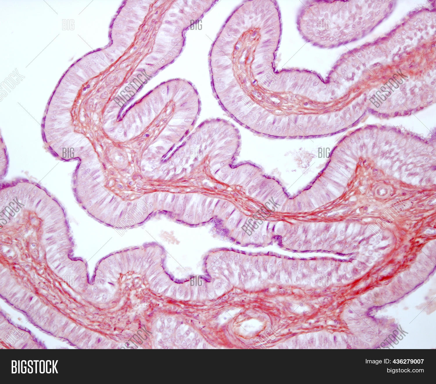 Mucosa Fallopian Tube Image & Photo (Free Trial) | Bigstock
