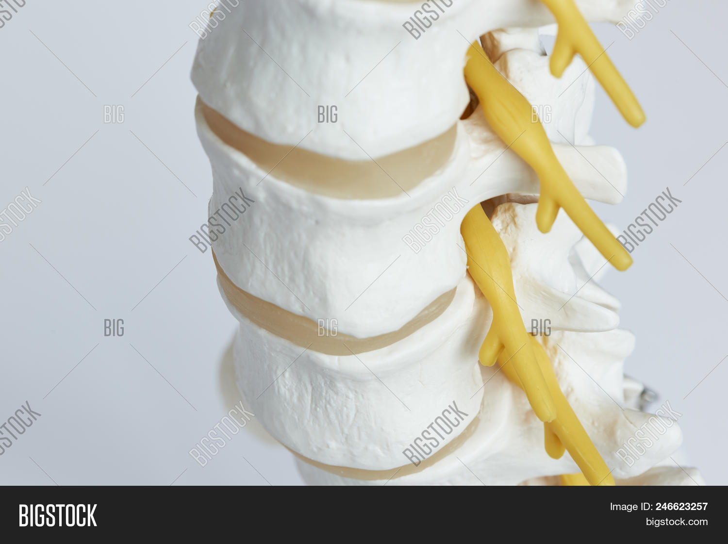 Close- View Nerve Root Image & Photo (Free Trial) | Bigstock