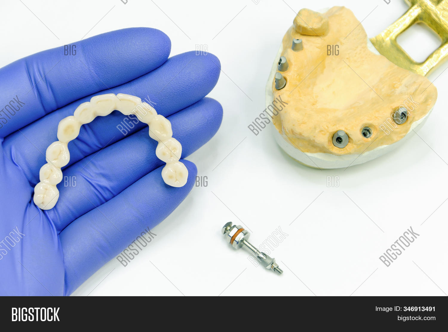 Artificial Teeth Image & Photo (Free Trial) | Bigstock