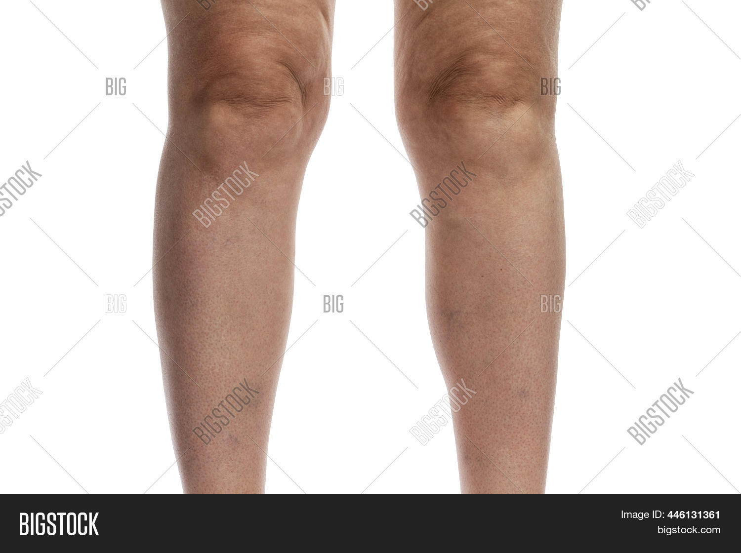 Thick Female Legs Image & Photo (Free Trial) | Bigstock