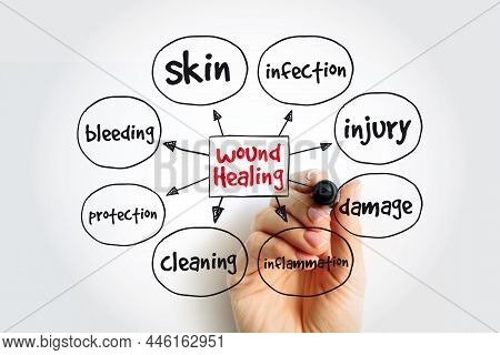 Wound Healing Mind Map Image & Photo (Free Trial) | Bigstock