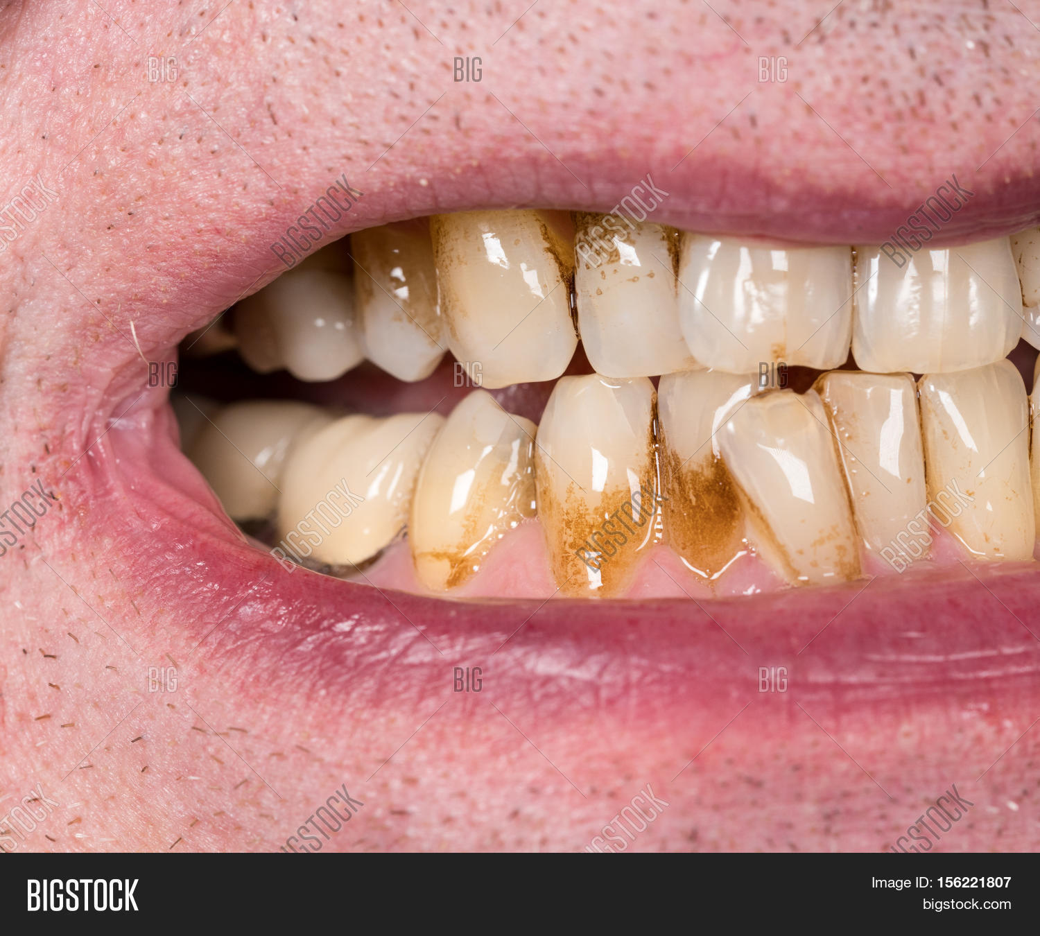 Close Mouth Brown Image & Photo (Free Trial) | Bigstock
