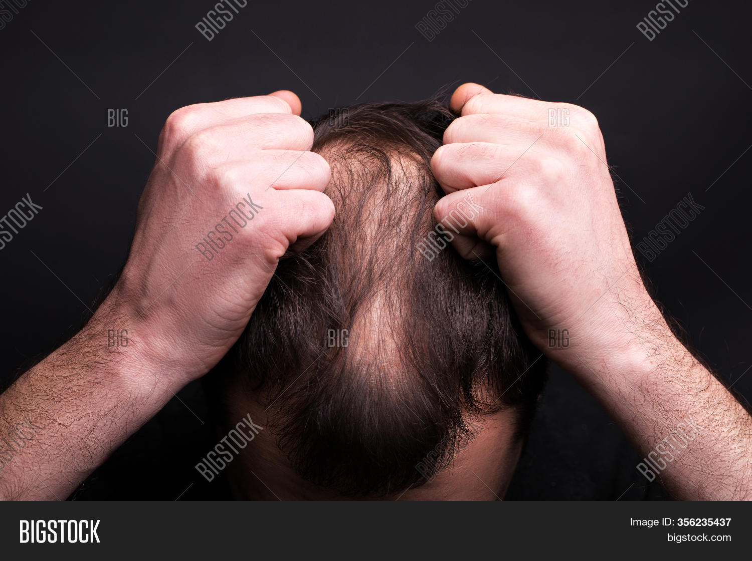 Man Grabs His Hair. Image & Photo (Free Trial) | Bigstock