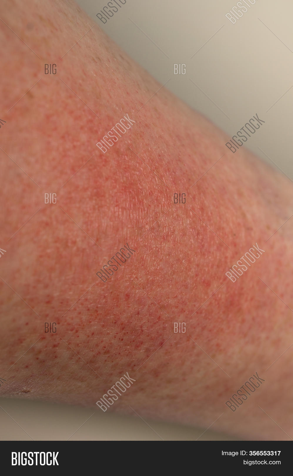 Manifestations Image & Photo (Free Trial) | Bigstock